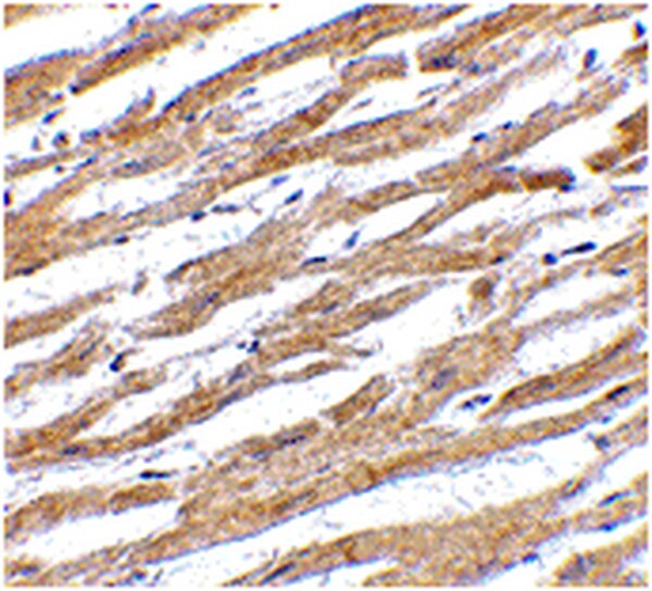 Anti-PDL-1 Antibody | ABC324